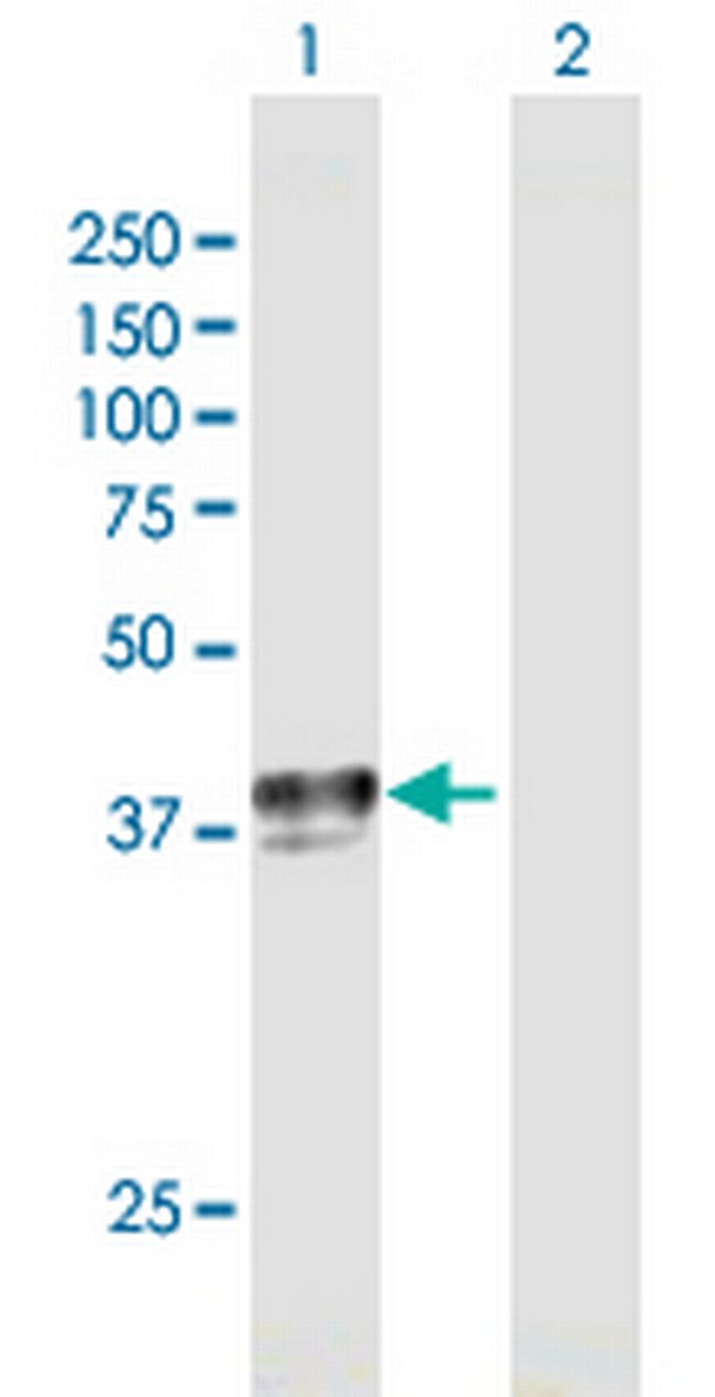 SLC29A1 Polyclonal Antibody (H00002030-B01P)