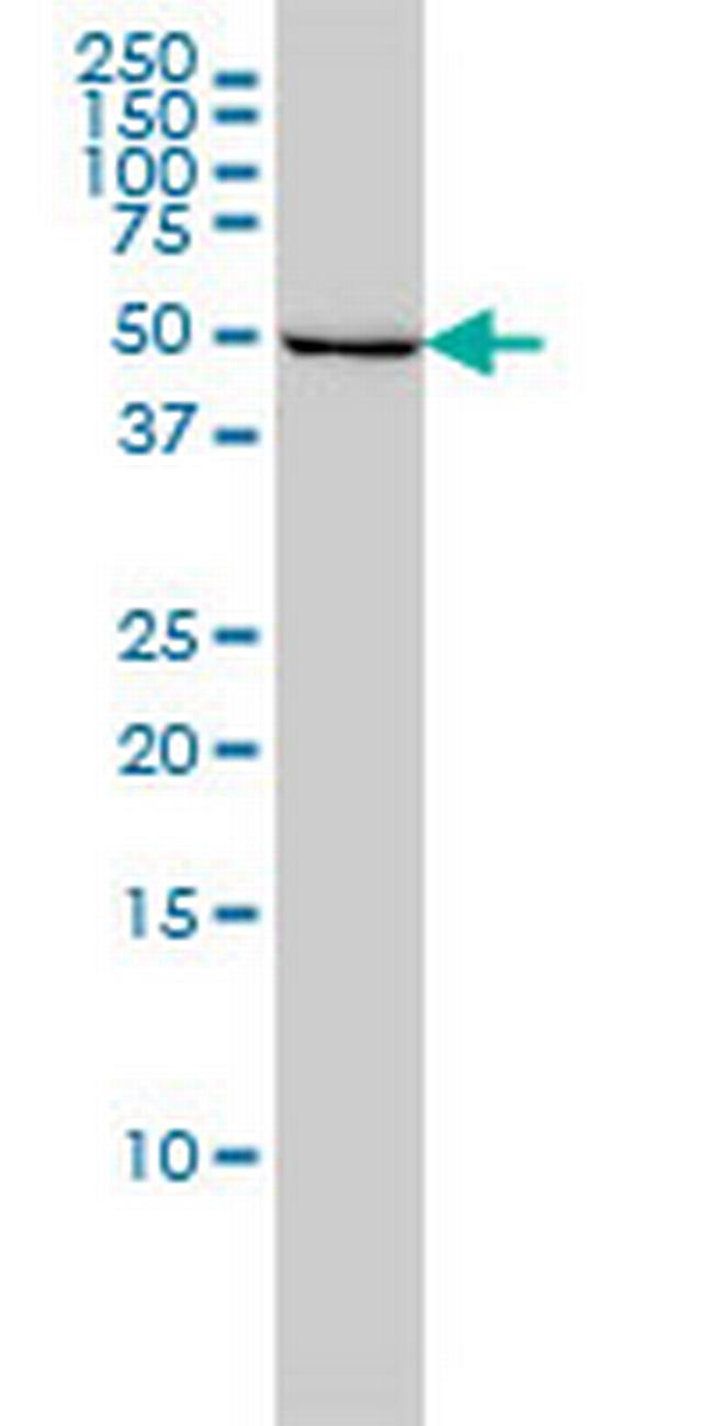 ILK Monoclonal Antibody (4F10) (H00003611-M01)