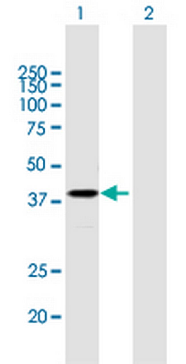 PSG2 Polyclonal Antibody (H00005670-B01P)