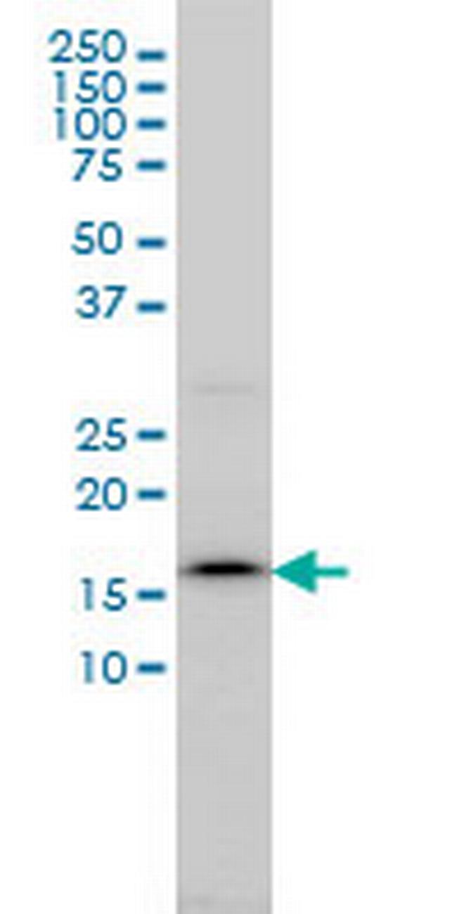 SSR4 Monoclonal Antibody (2D3) (H00006748-M01)