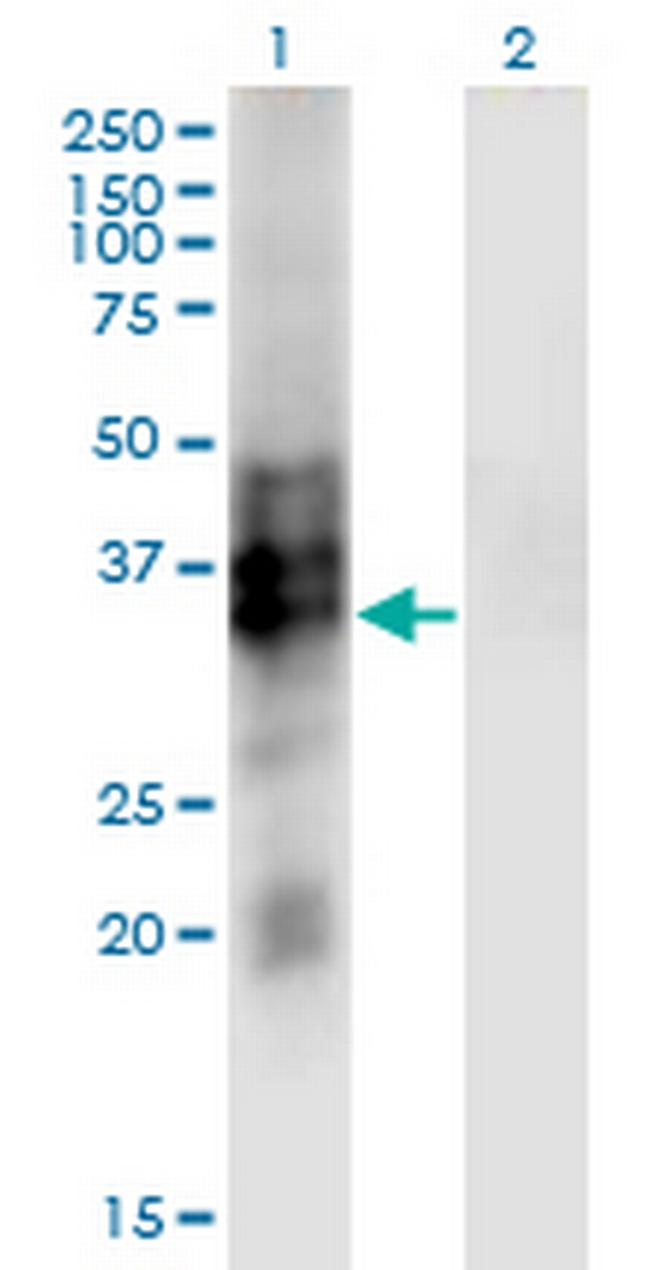 SYP Monoclonal Antibody (3B3) (H00006855-M01)
