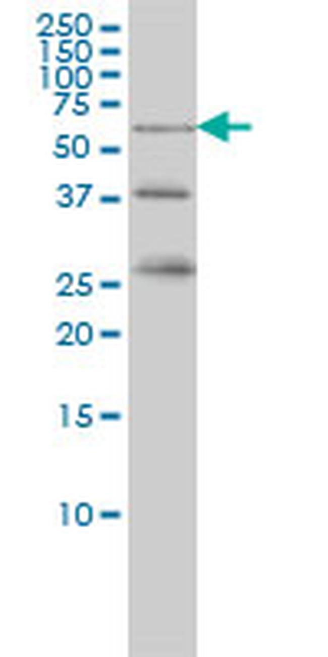RIOK3 Antibody (H00008780-M02)