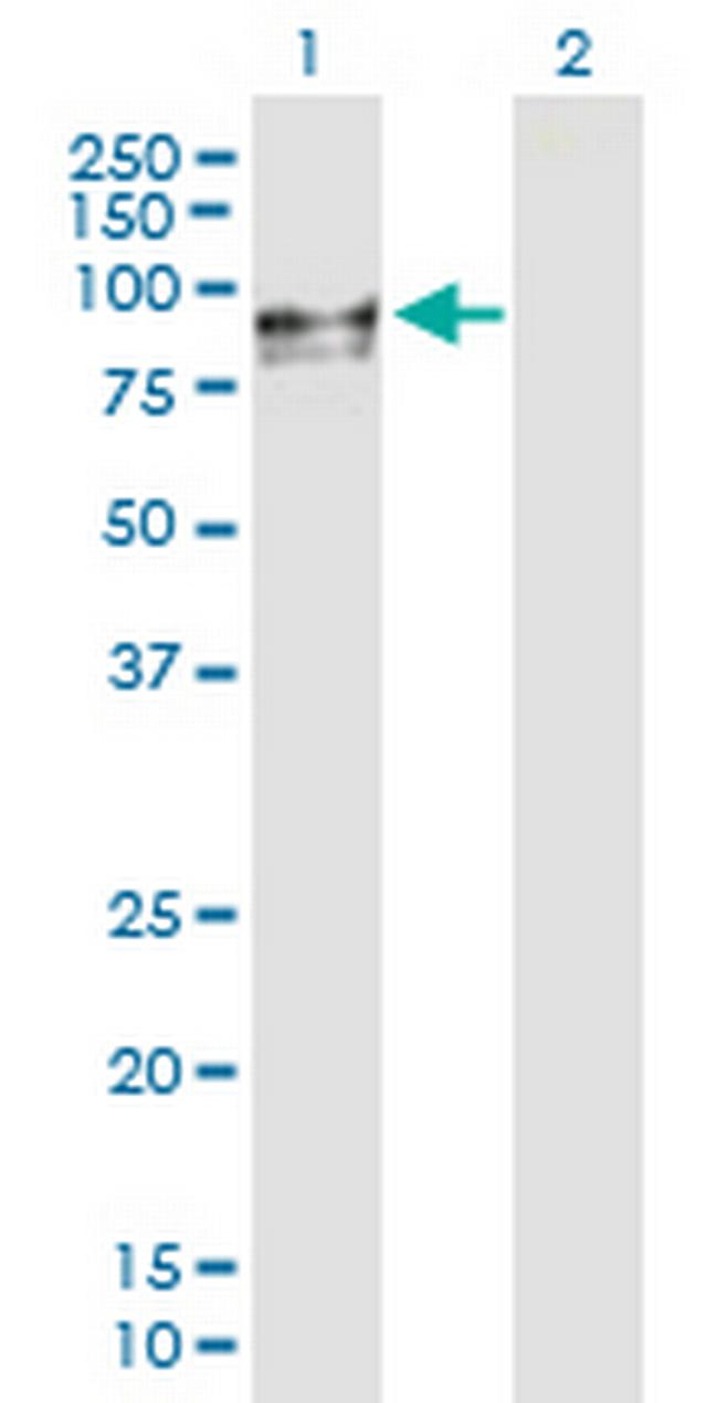 PREPL Polyclonal Antibody (H00009581-B01P)