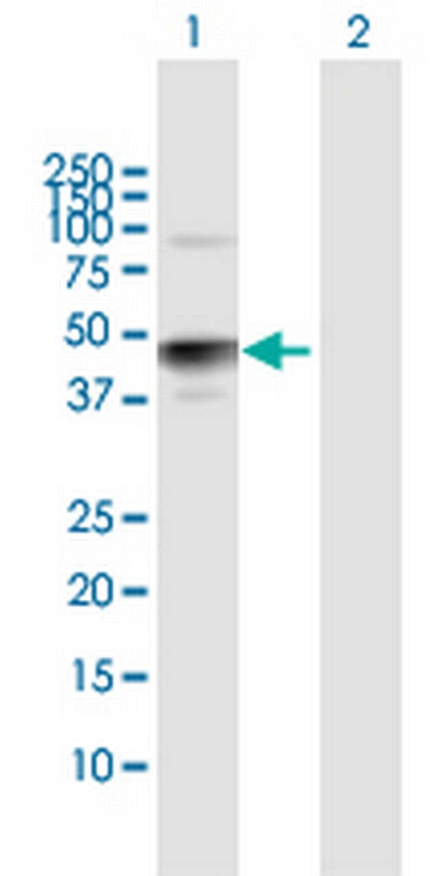 HS3ST3A1 Polyclonal Antibody (H00009955-D01P)