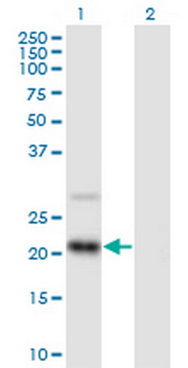 RAX2 Polyclonal Antibody (H00084839-B01P)