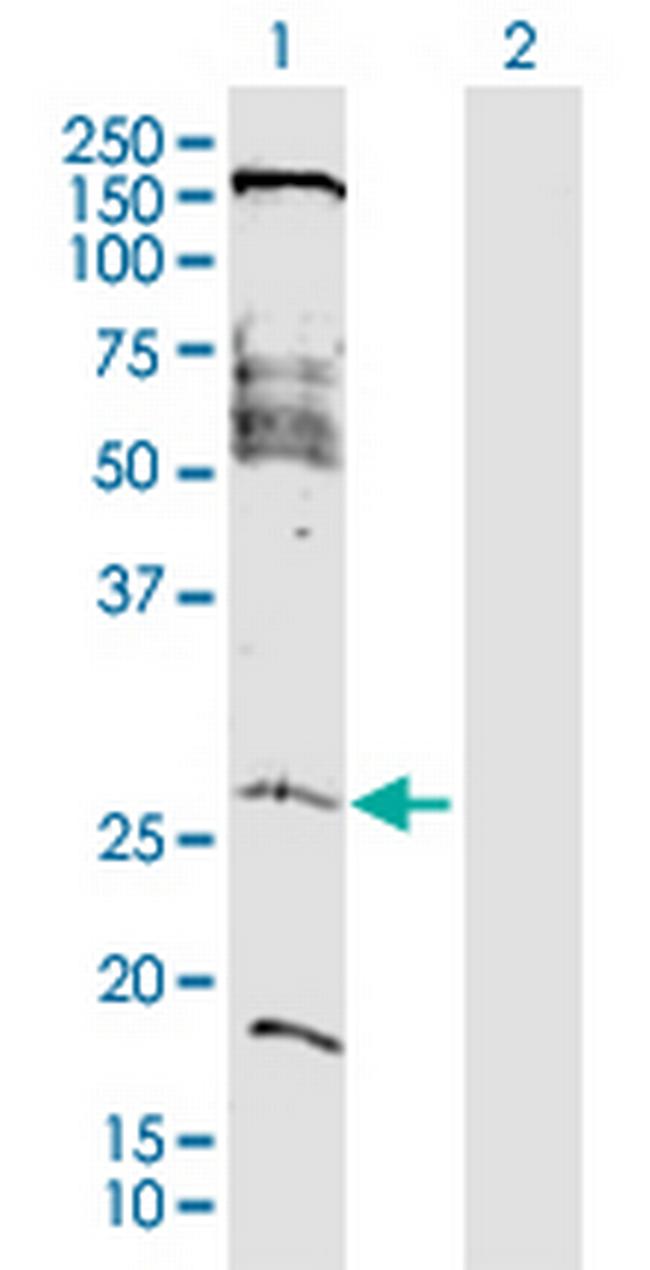 FAM177A1 Polyclonal Antibody (H00283635-D01P)