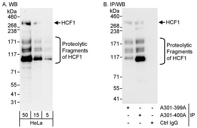 HCF1 Polyclonal Antibody (A301-400A)