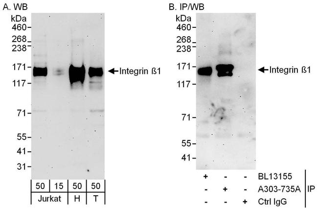 Integrin Beta 1 Polyclonal Antibody (A303-735A)
