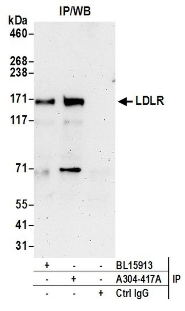 LDLR Polyclonal Antibody (A304-417A)