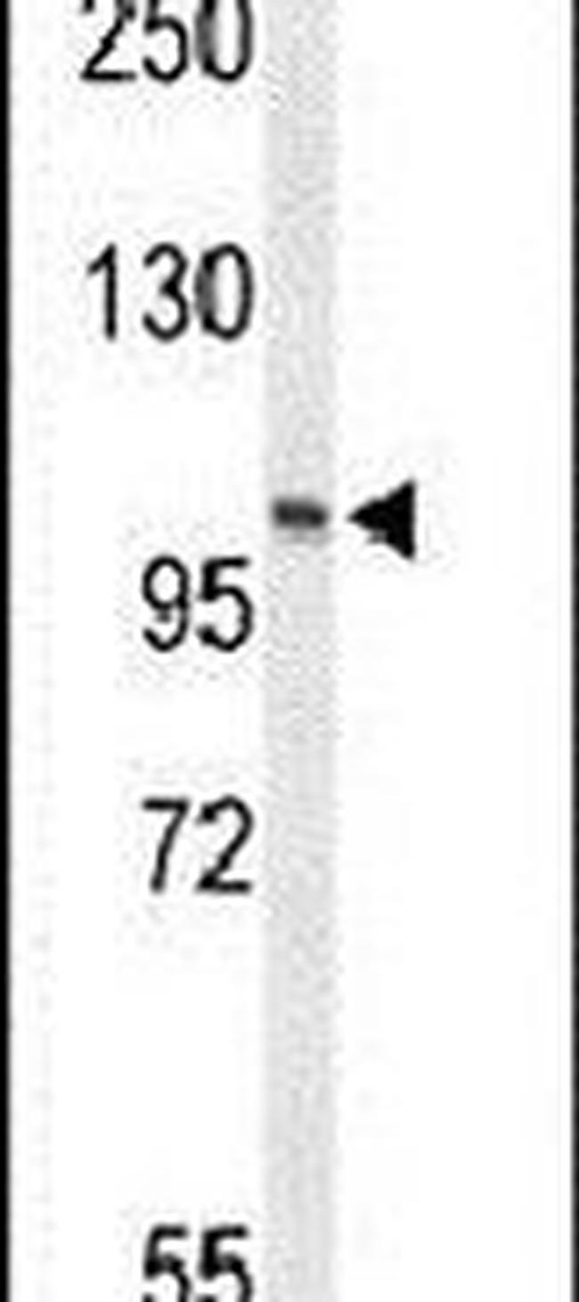 HSL Antibody (PA5-26383)