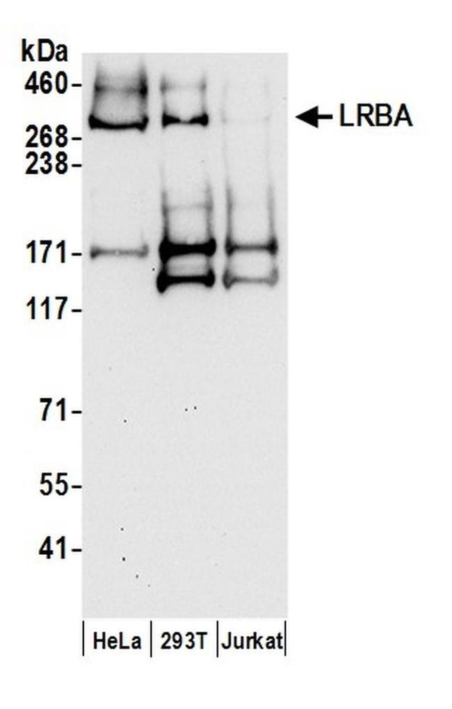 LRBA Polyclonal Antibody (A304-478A-T)