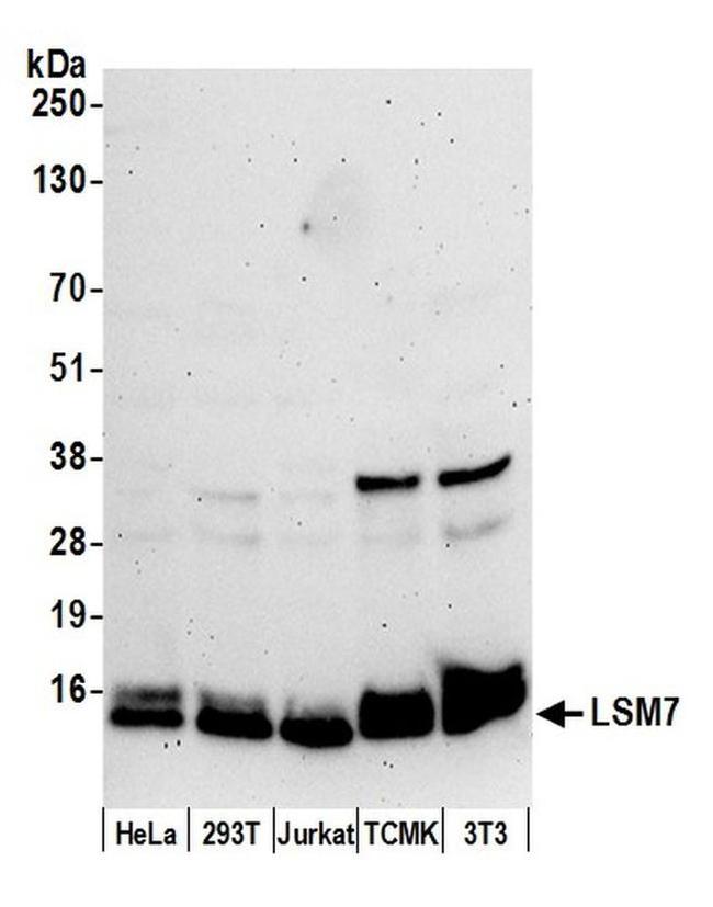 LSM7 Polyclonal Antibody (A305-097A)