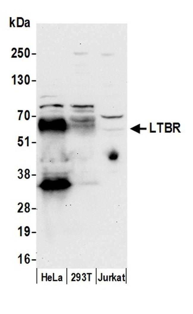 LTBR/Lymphotoxin-beta Receptor Polyclonal Antibody (A305-189A-T)