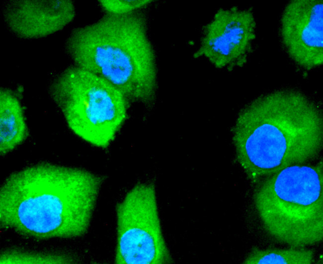 CD31 Monoclonal Antibody (7-A1) (M1511-8)
