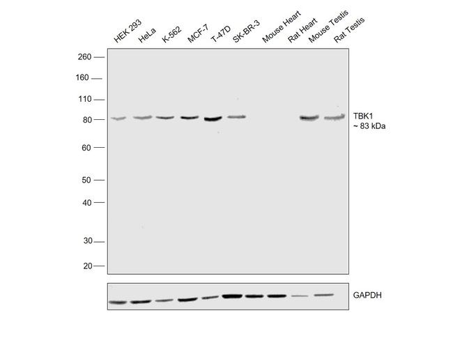 TBK1 Monoclonal Antibody (108A429) (MA1-20344)