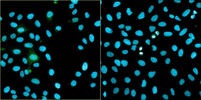 Bovine Papilloma Virus Type 1 E2 Antibody (MA1-71534)