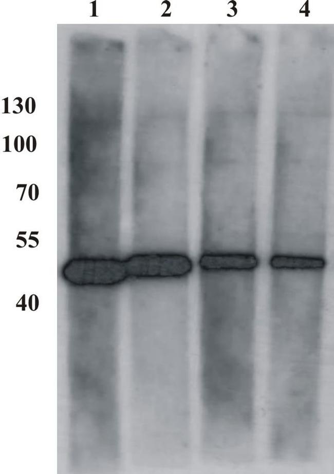 Bovine Papilloma Virus Type 1 E2 Antibody (MA1-71534)