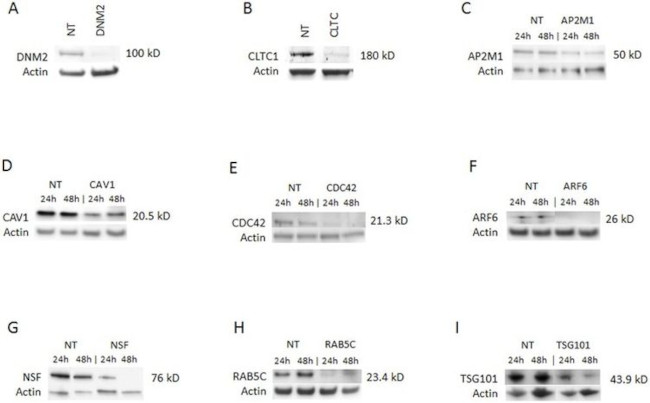 Clathrin Heavy Chain Antibody (MA1-065)