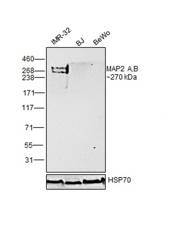 MAP2 Monoclonal Antibody (MT-08) (MA1-19426)