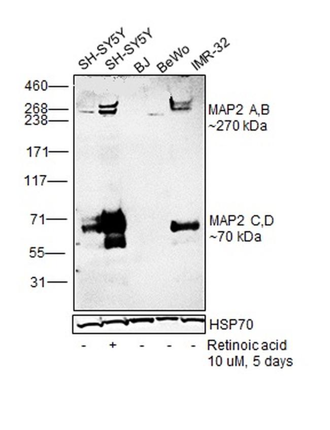 MAP2 Monoclonal Antibody (HM-2) (MA1-25043)
