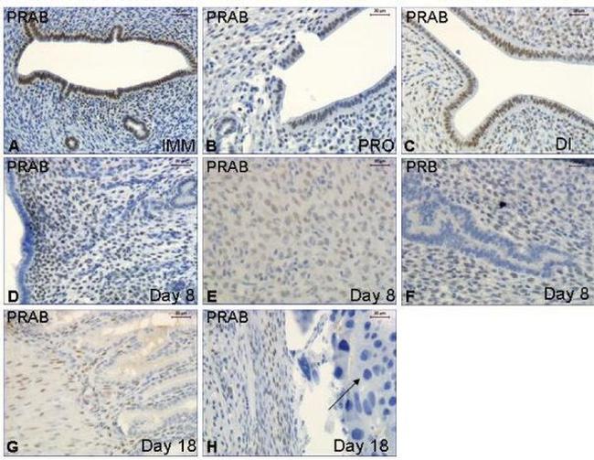 Progesterone Receptor Antibody (MA1-411)