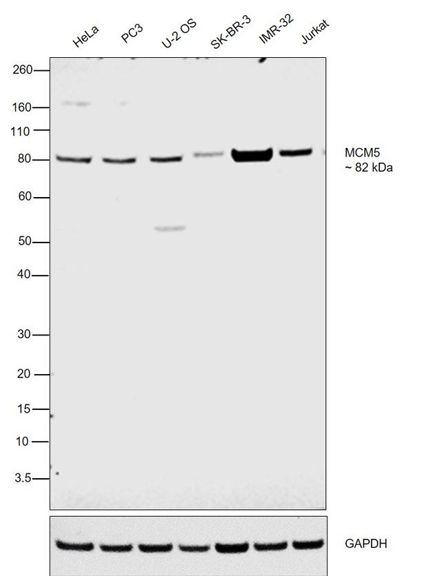 MCM5 Monoclonal Antibody (CRCT5.1) (MA1-80807)
