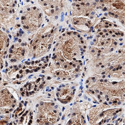 MGMT Antibody (MA3-16537)