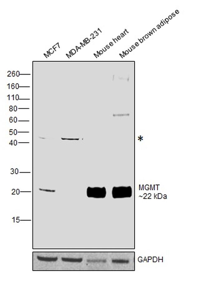 MGMT Antibody (MA3-16537)