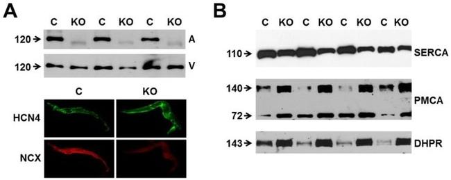CACNA2D1 Antibody (MA3-921)