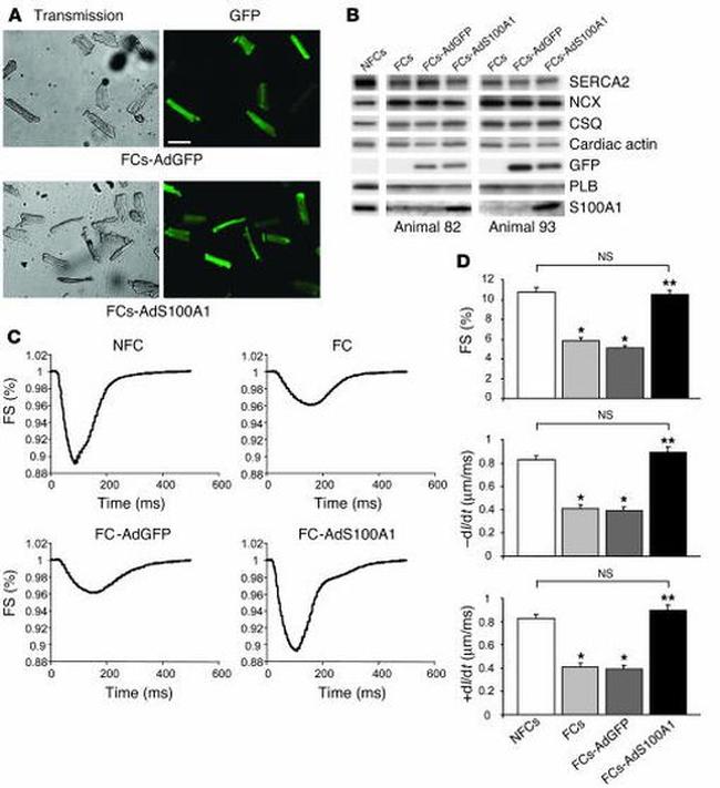 Sodium/Calcium Exchanger Antibody (MA3-926)