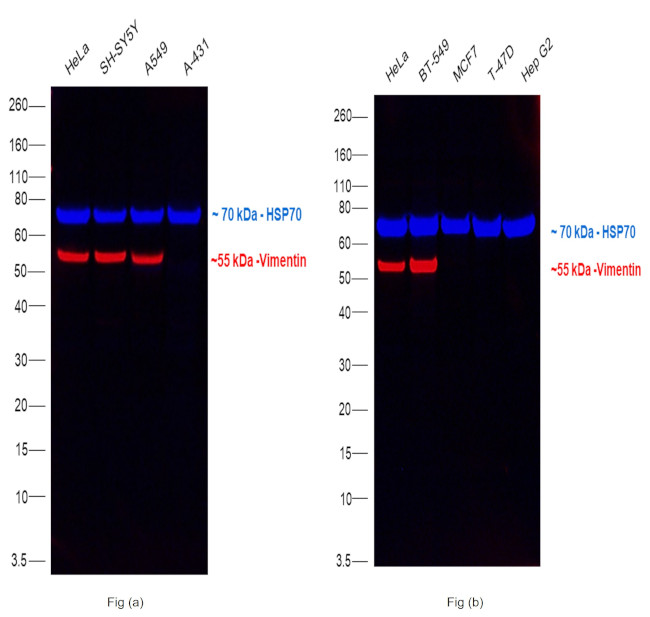 Vimentin Monoclonal Antibody (V9), Alexa Fluor™ 647 (MA5-11883-A647)