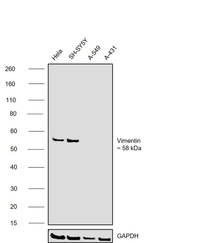 Vimentin Monoclonal Antibody (V9) (MA5-11883)