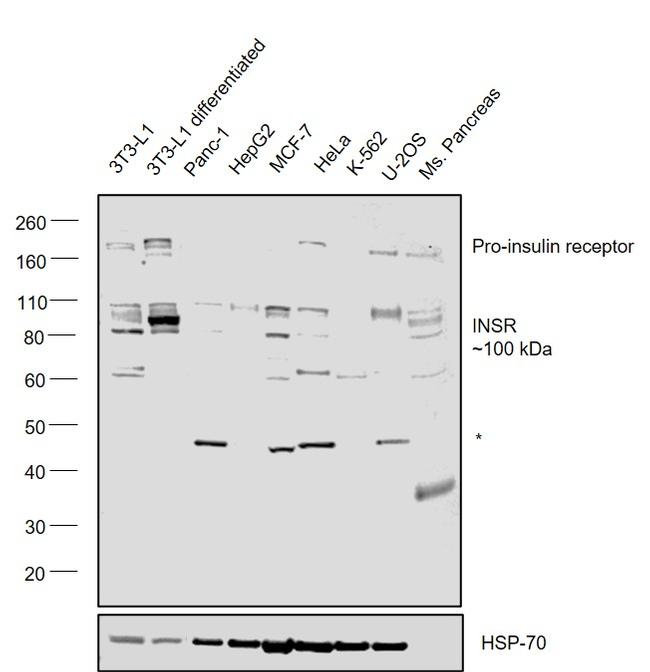 INSR Monoclonal Antibody (CT-3) (MA5-13783)