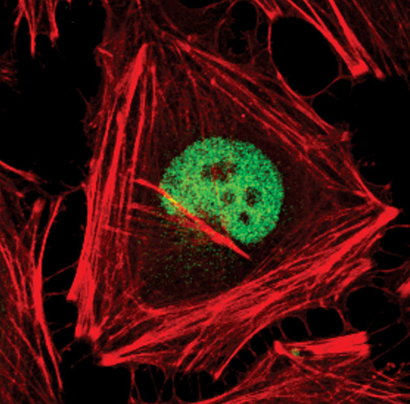 AP2 alpha Antibody (MA5-14856)