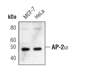 AP2 alpha Monoclonal Antibody (R.387.0) (MA5-14856)