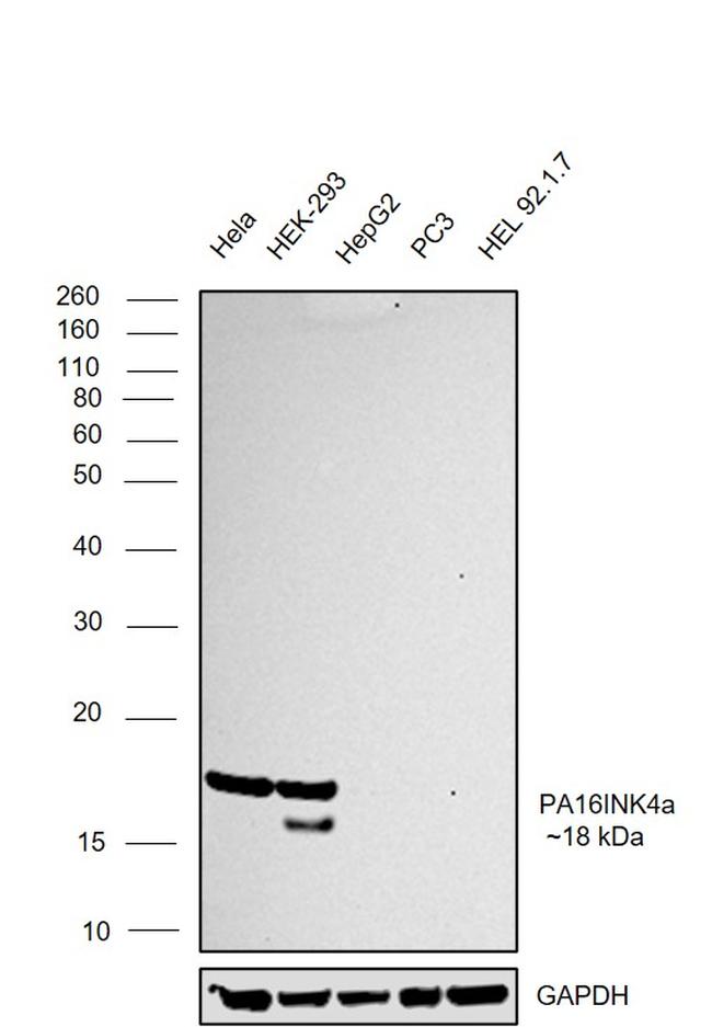 p16INK4a Monoclonal Antibody (1D7D2) (MA5-17054)