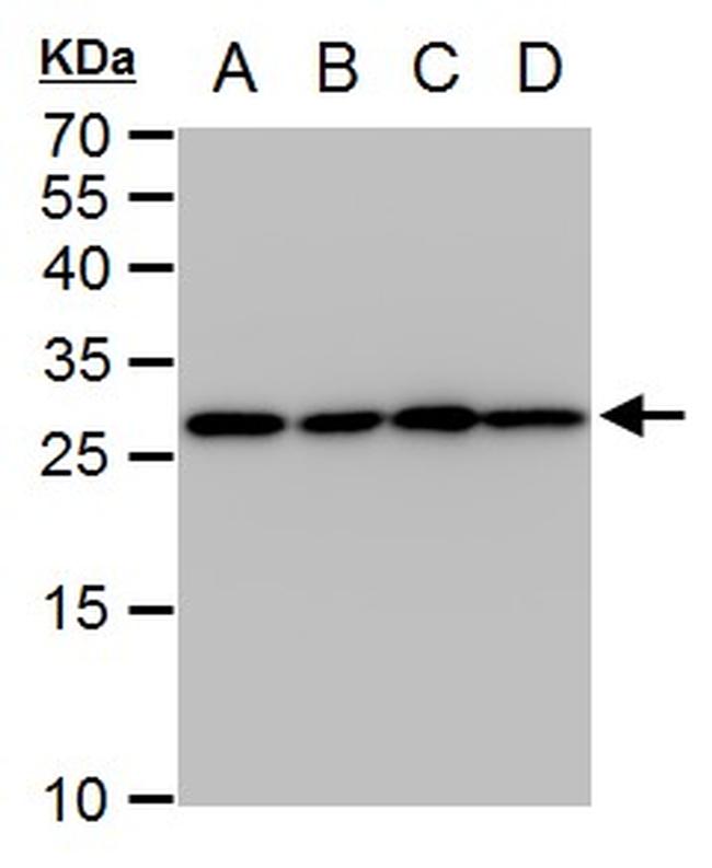 TPI1 Antibody (MA5-18291)