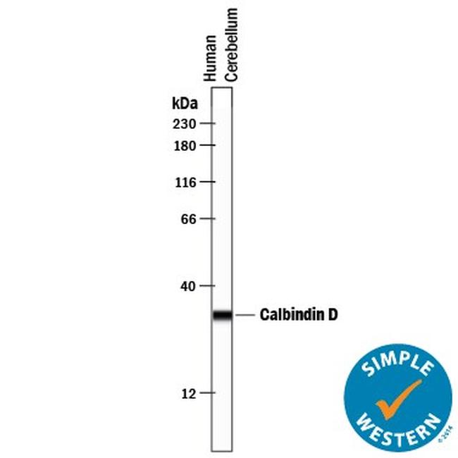 Calbindin D28K Antibody (MA5-24135)