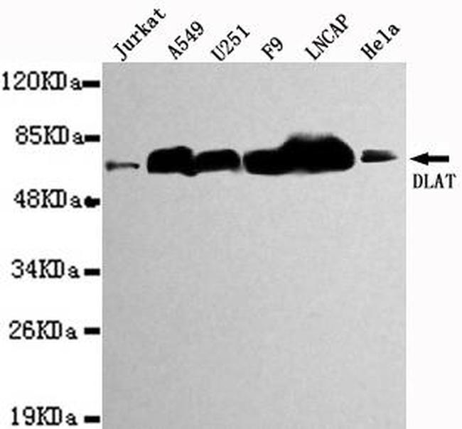 DLAT Monoclonal Antibody (4G9) (MA5-24863)