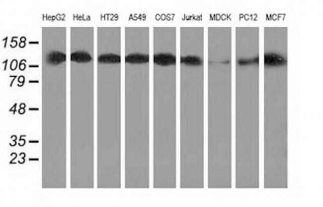 HDAC6 Antibody (MA5-25326)