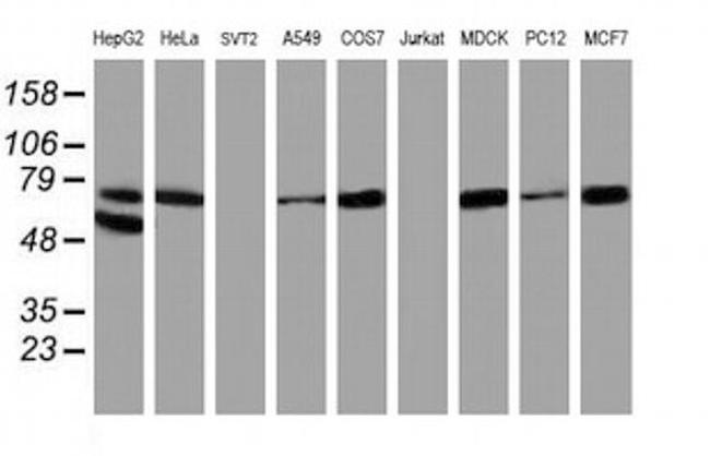 ALOX15 Monoclonal Antibody (OTI3G8) (MA5-25853)