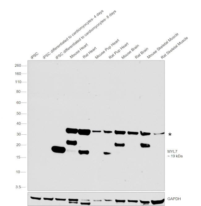 MYL7 Monoclonal Antibody (OTI4E7) (MA5-26390)