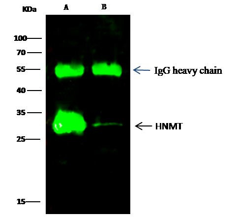 HNMT Recombinant Monoclonal Antibody (034) (MA5-29324)