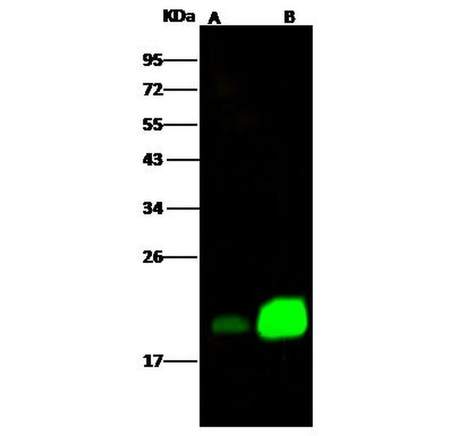 NPC2 Recombinant Monoclonal Antibody (012) (MA5-29449)