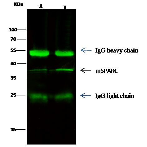 SPARC Recombinant Monoclonal Antibody (001) (MA5-29821)