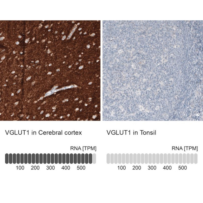 VGLUT1 Monoclonal Antibody (CL2754) (MA5-31373)