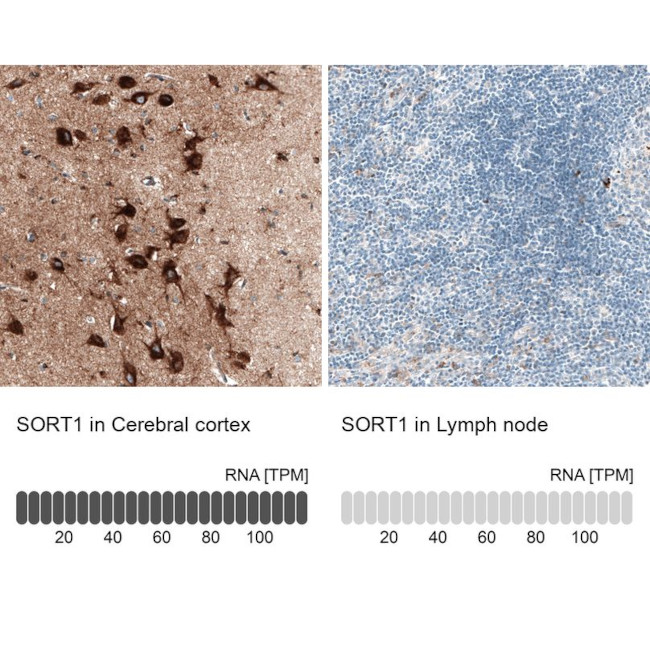 Sortilin Monoclonal Antibody (CL6526) (MA5-31437)