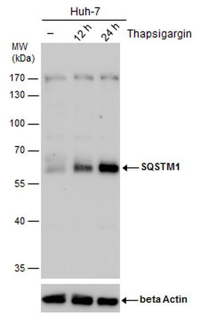 SQSTM1 Antibody (MA5-31498)