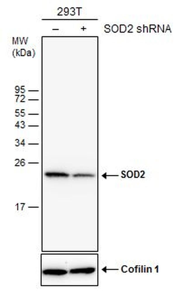 SOD2 Antibody (MA5-31514)