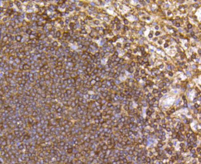 CCR7 Antibody (MA5-31992)